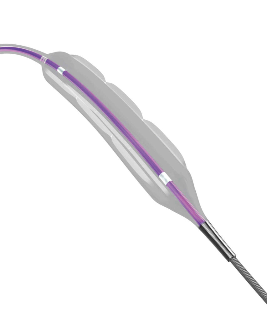 Bóng nong mạch vành chống trượt – NSE ALPHA - Nipro Sales Việt Nam